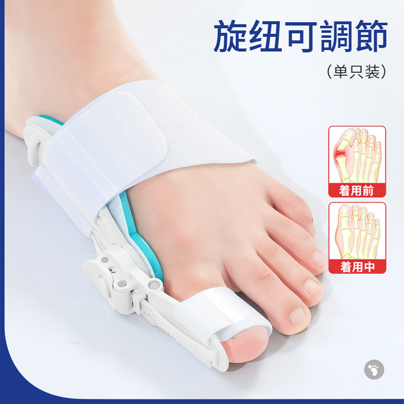 [USD 41.64] Toe orthodontics divided into the toe foot of the mother to ...