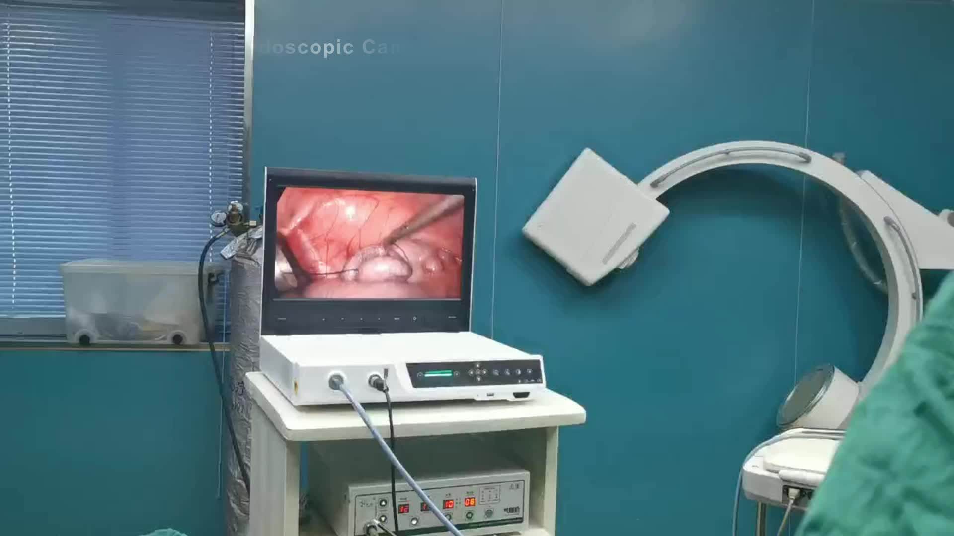 Ikeda 9101 Full Hd Portable Histeroscopio Nephroscope Endoscope Camera For Endoscopy System ...