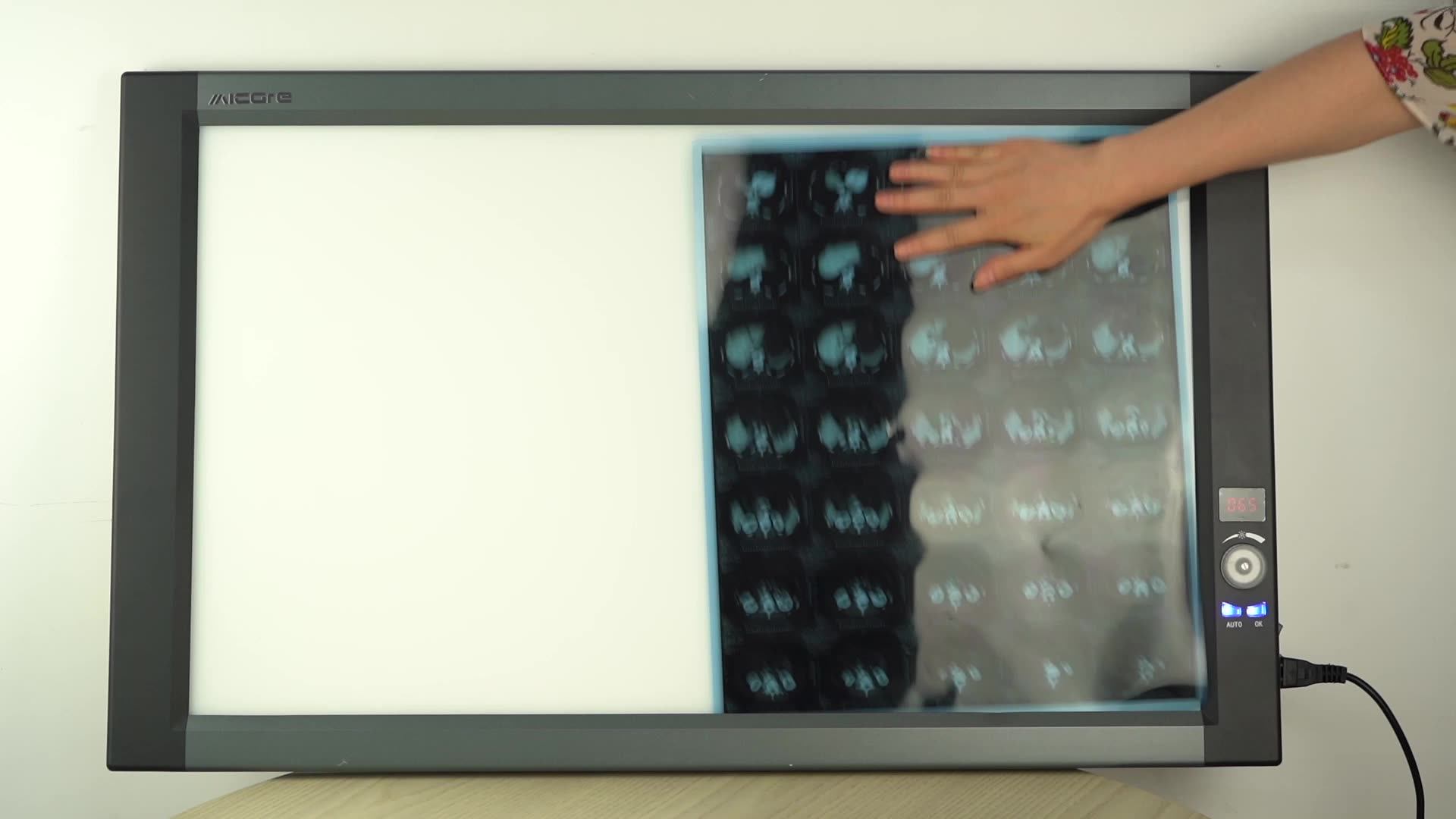 Zg-2c Double Panel X-ray Led Medical Film Viewer - Buy Negatoscopes ...