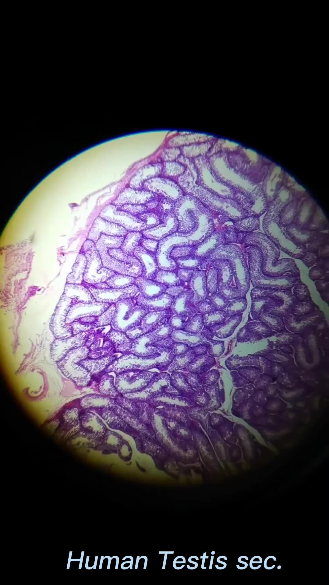 Glass Material And Other Subject 100pcs Human Histology Slides Set Red ...