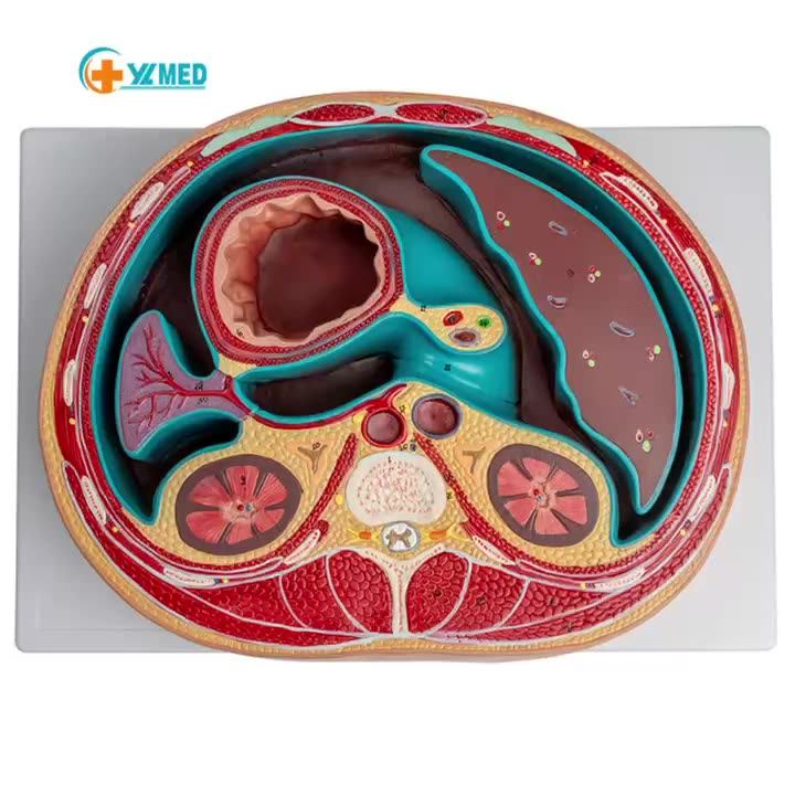 Medical Science Abdominal Cross Section Anatomy Thoracic Vertebra Liver ...