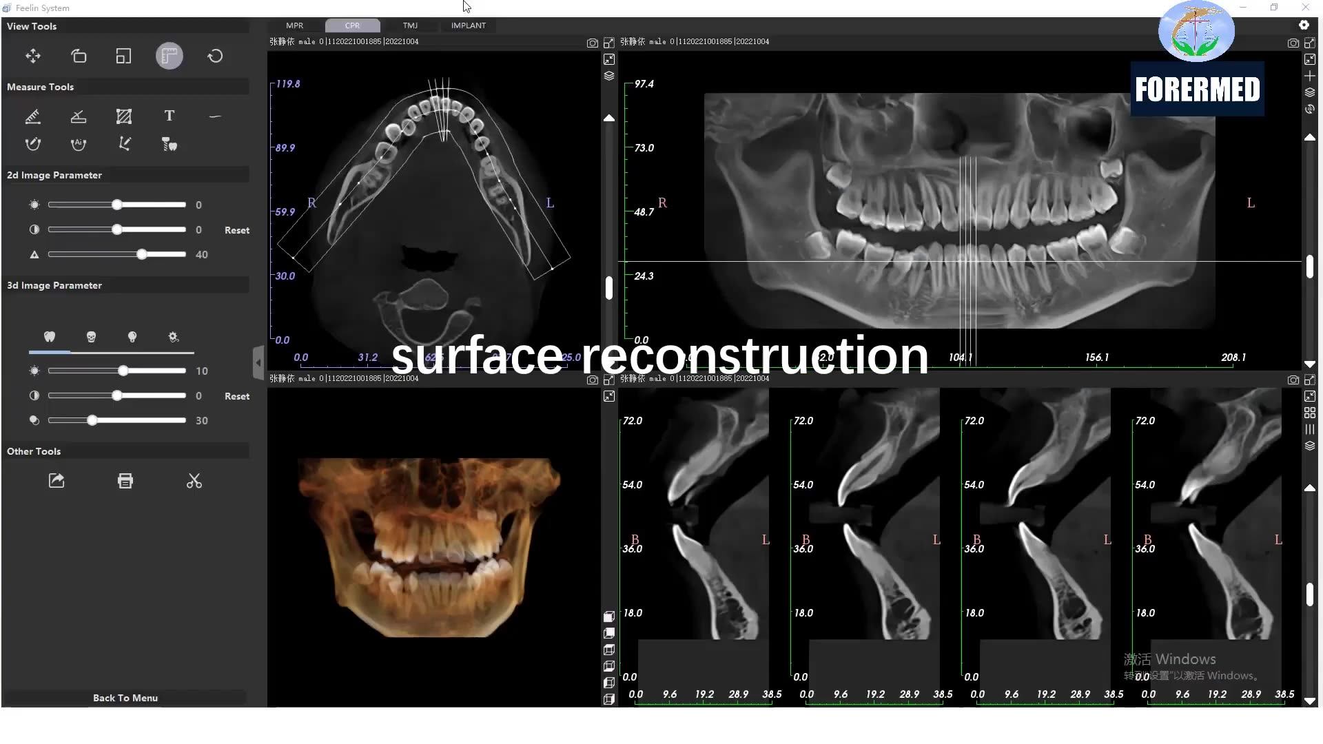 4 In 1 Digital Cbct Dental X Ray M2 Fov Cone Beam Ai Computed ...
