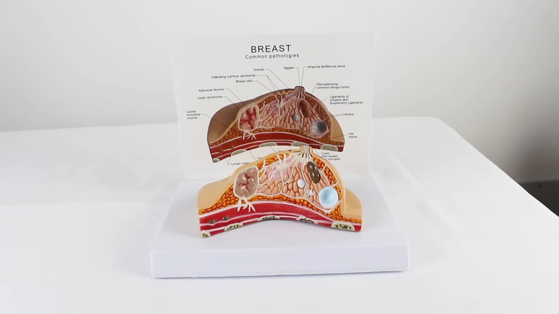 Human Breast Cross-section Pathology Model - Buy Breast Model,Human ...