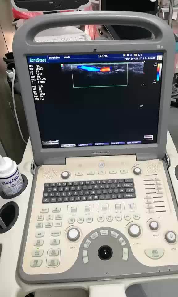 Sonoscape S8 Mini Portable Ultrasound Machines/4d Ultrasound Scan - Buy ...