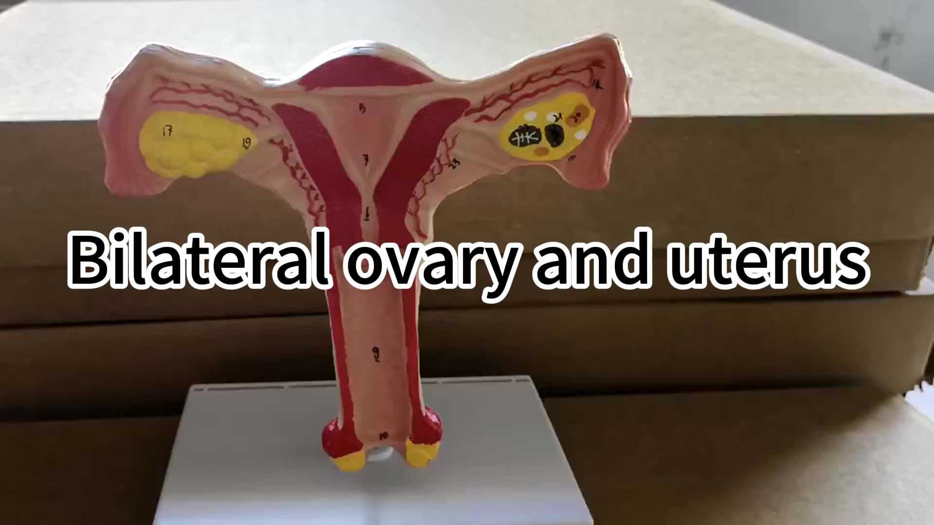 Manufacturers Supply Human Uterine Anatomy Model Ovarian Anatomical ...
