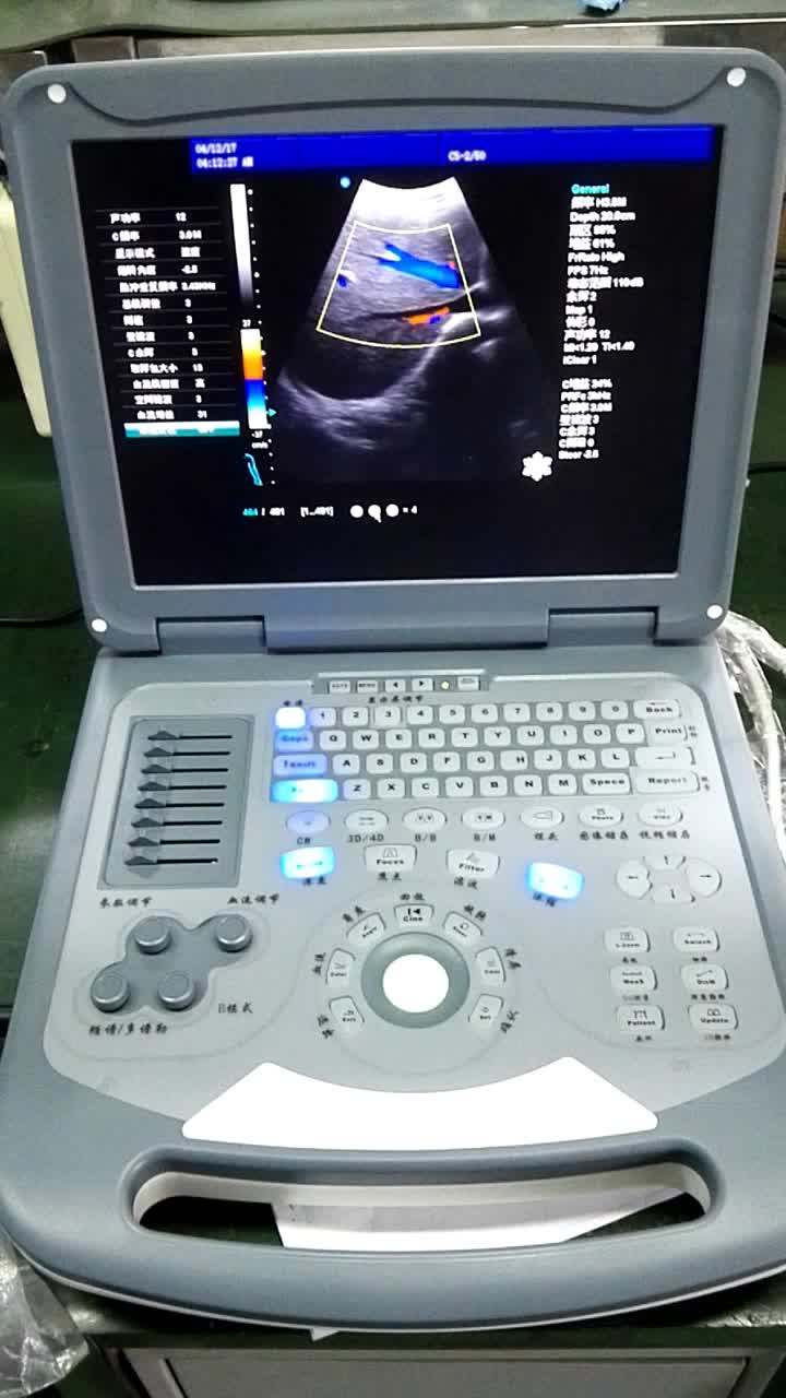 Laptop Full-digital Portable Color Doppler Echo Machine Scanner - Buy ...