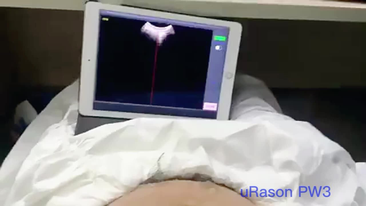 Lannx Urason Pw3 Innovative Design 4d Wireless Probe Bladder Ultrasound Scan Portable Wireless ...