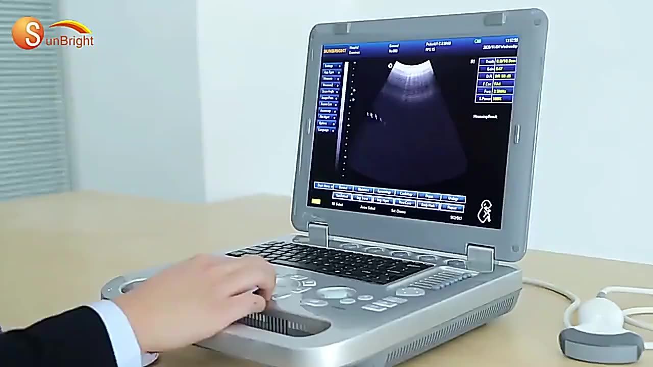 Ultrasound Vascular Cardiac Fetal Scan 3d Sonogram Best Offer - Buy ...