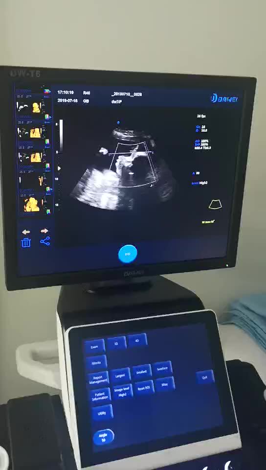 Real Time 4d Ultrasound Machine Factories & 4d Color Doppler Ultrasound ...
