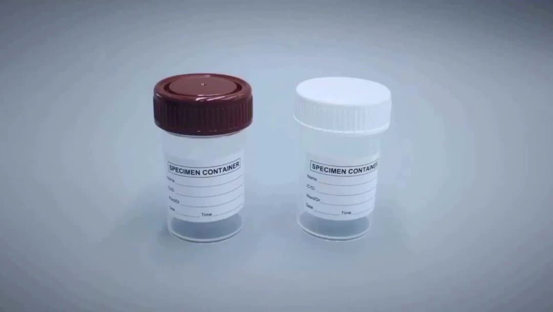 Sterile Disposable 60ml Plastic Urine Specimen Container - Buy Urine ...