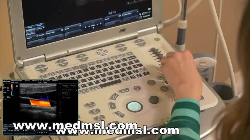 Mindray M7 4d Color Ultrasound Machine,Mindray Ultrasound - Buy Mindray ...