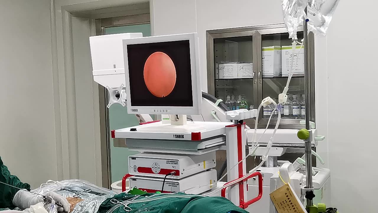 Shrek Office Integrated Endoscopy Camera Unit For Hysteroscopy Ent Vet ...