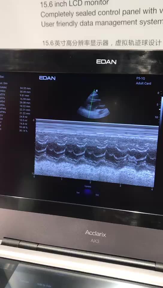 Edan Acclarix Ax3 Ax8 Echocardiography Ultrasound Machine Price For ...