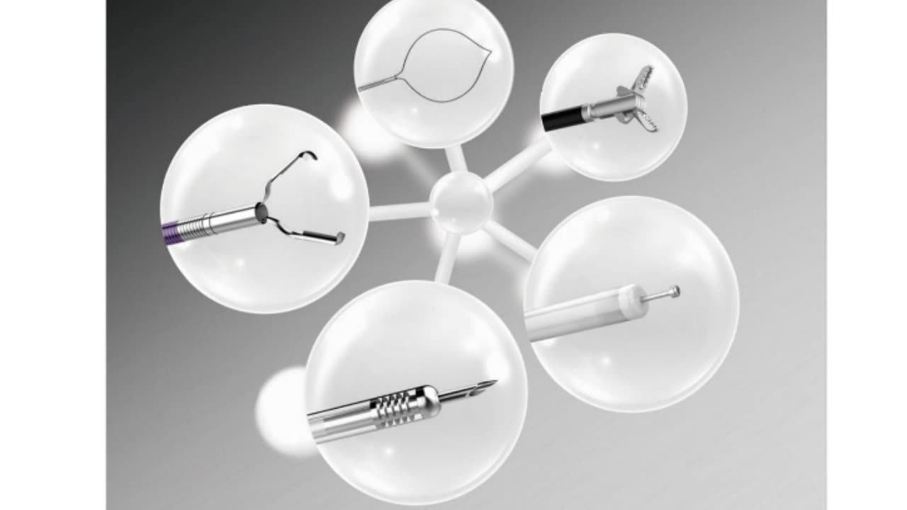 Esophageal Balloon Dilatation Catheter Pta Balloon Dilatation Catheter ...