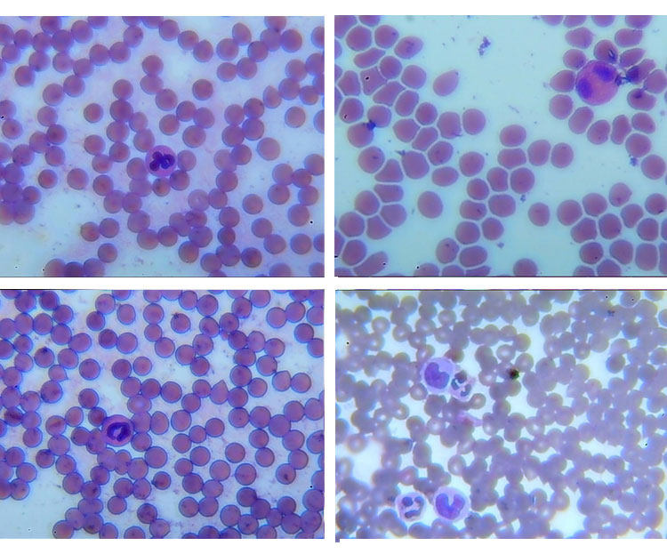 迪夫快速染色液 Diff-Quik 迪夫染色固定液 [PH1057 PHYGENE]-阿里巴巴