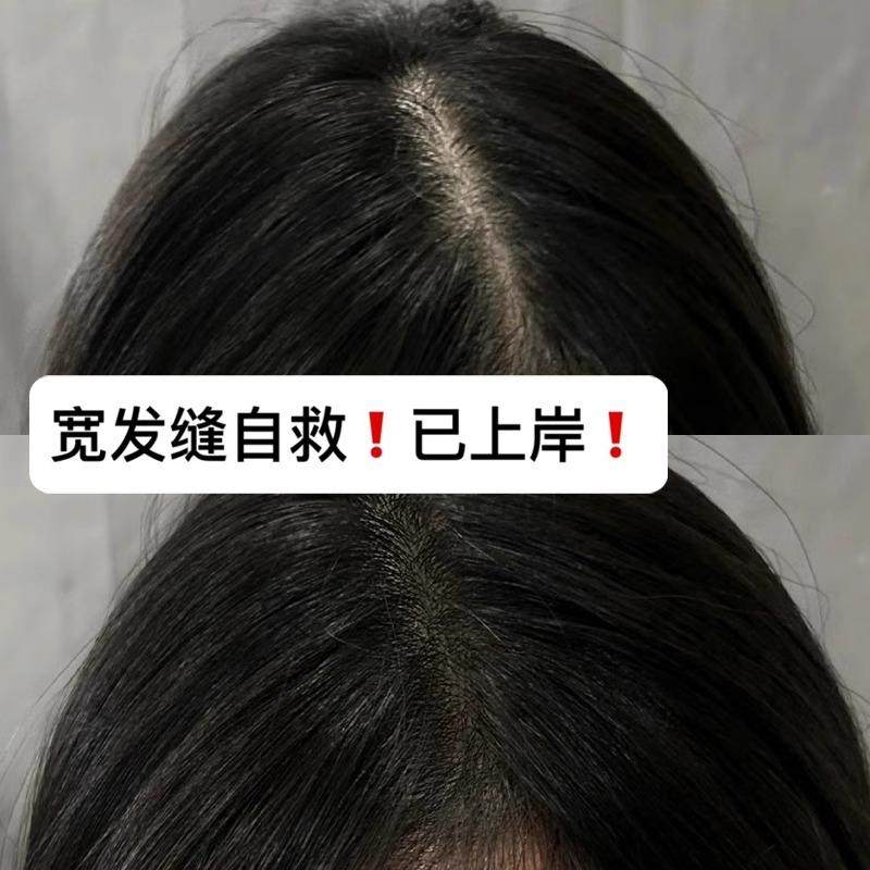 在时光缝隙中，让发际线与我一同重生_阴影_淘宝美妆网