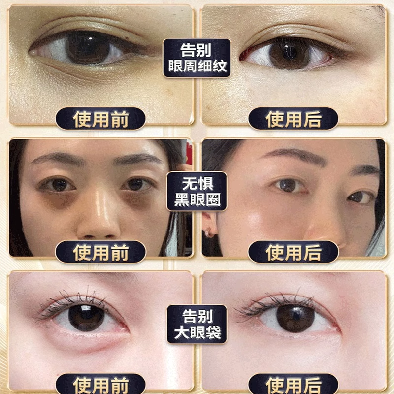 所有女生！这支眼霜是美容院同款，闭眼入！逆龄舒纹滚珠眼霜15g，你值得拥有！_眼部精华_淘宝美妆网