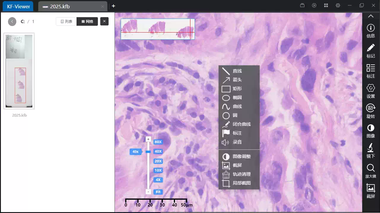 K-Viewer医学切片查看1.7版KViewer支持荧光 赠KFB转SVS,TIF工具