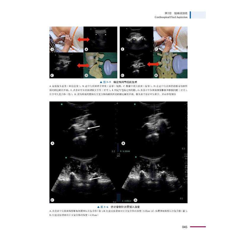 重症超声学的宝藏书籍？IRWIN & RIPPE《重症超声学》到底值不值得一看？-影像医学-淘宝好物网