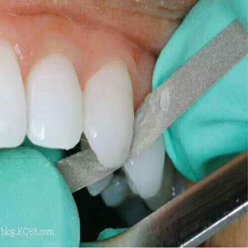Teeth grinding strips 🌟 : a magical tool for correcting molars, say ...