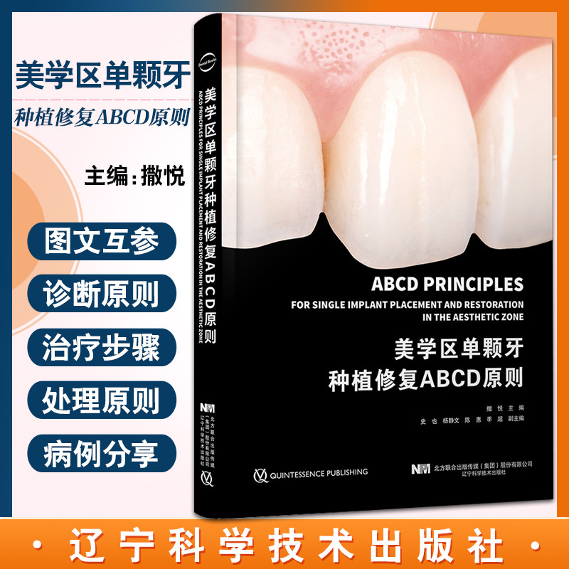 ABCD principle of single dental planting restoration ABCD expounds the ...