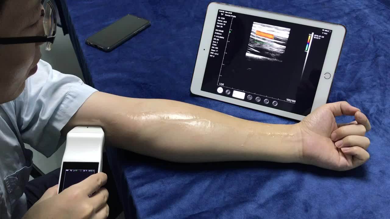 Simple Operation Wireless Color Doppler Diagnostic Portable Handheld ...