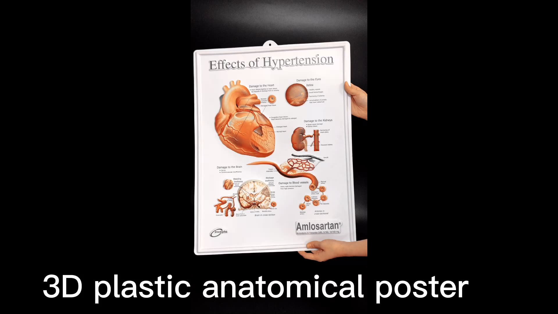 Customized 3d Medical Poster Pvc Medical Wall Chart With Design - Buy ...