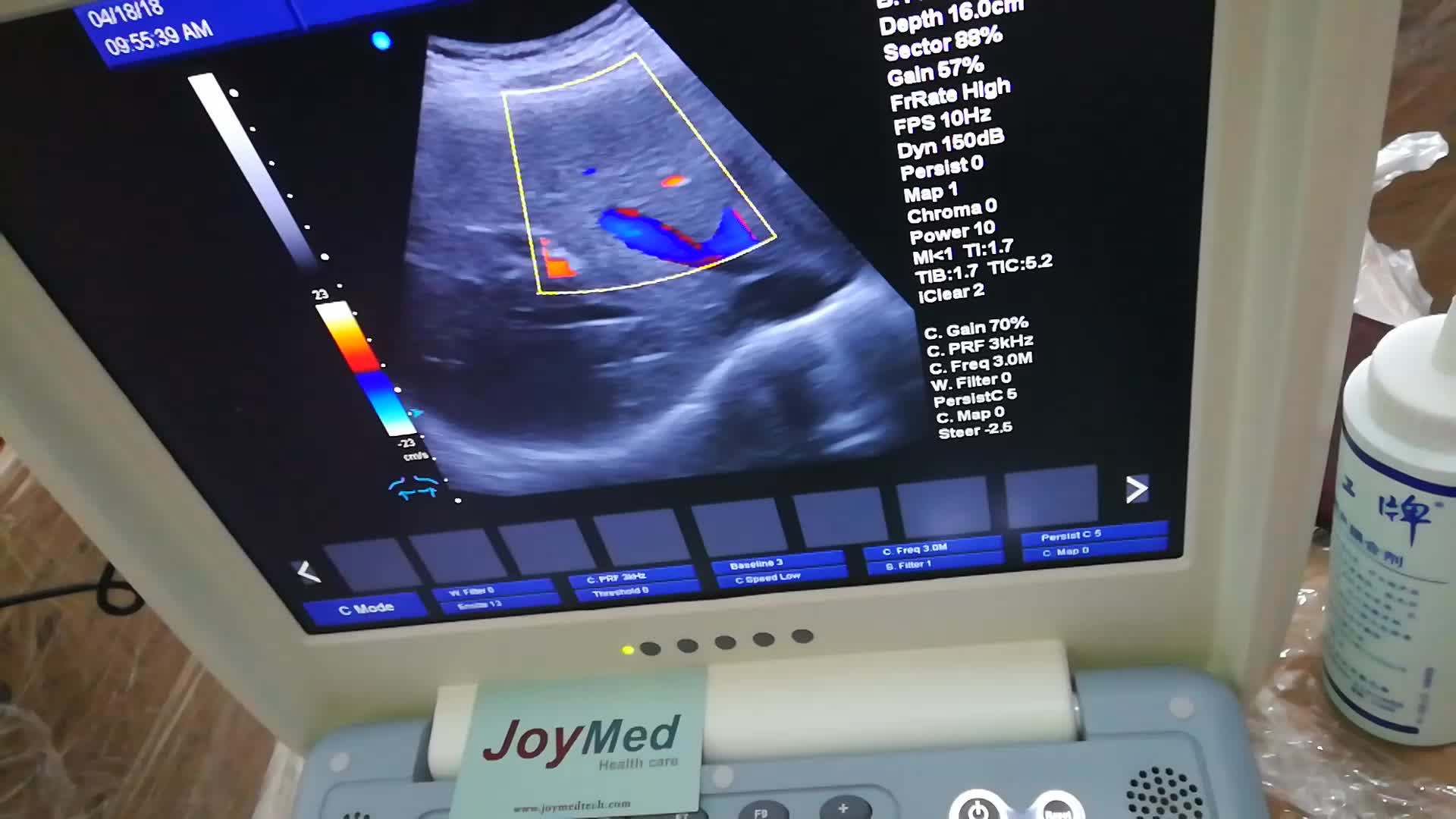 Hospital Portable 3d Ultrasound Scanner Color Doppler Pregnancy ...