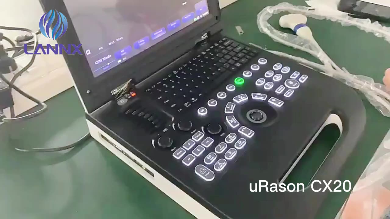 Lannx Urason Cx20 Hd Screen Laptop Digital Cardiology Ultrasound Medical 2d/3d Optional ...