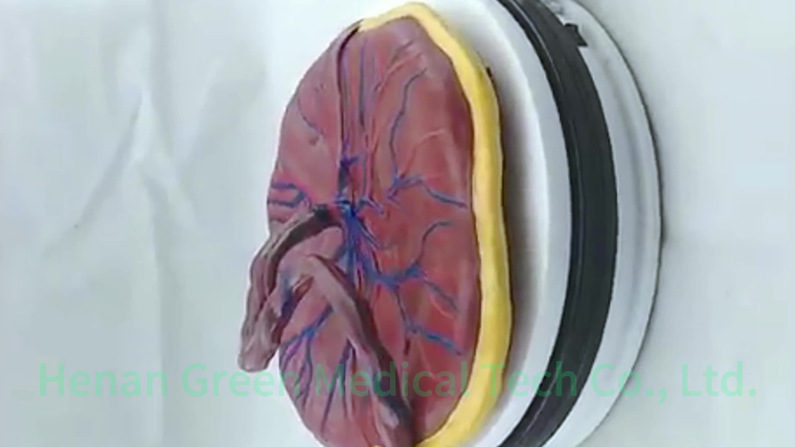 Placenta Anatomical Model With Umbilical Cord - Buy Placenta Anatomical ...