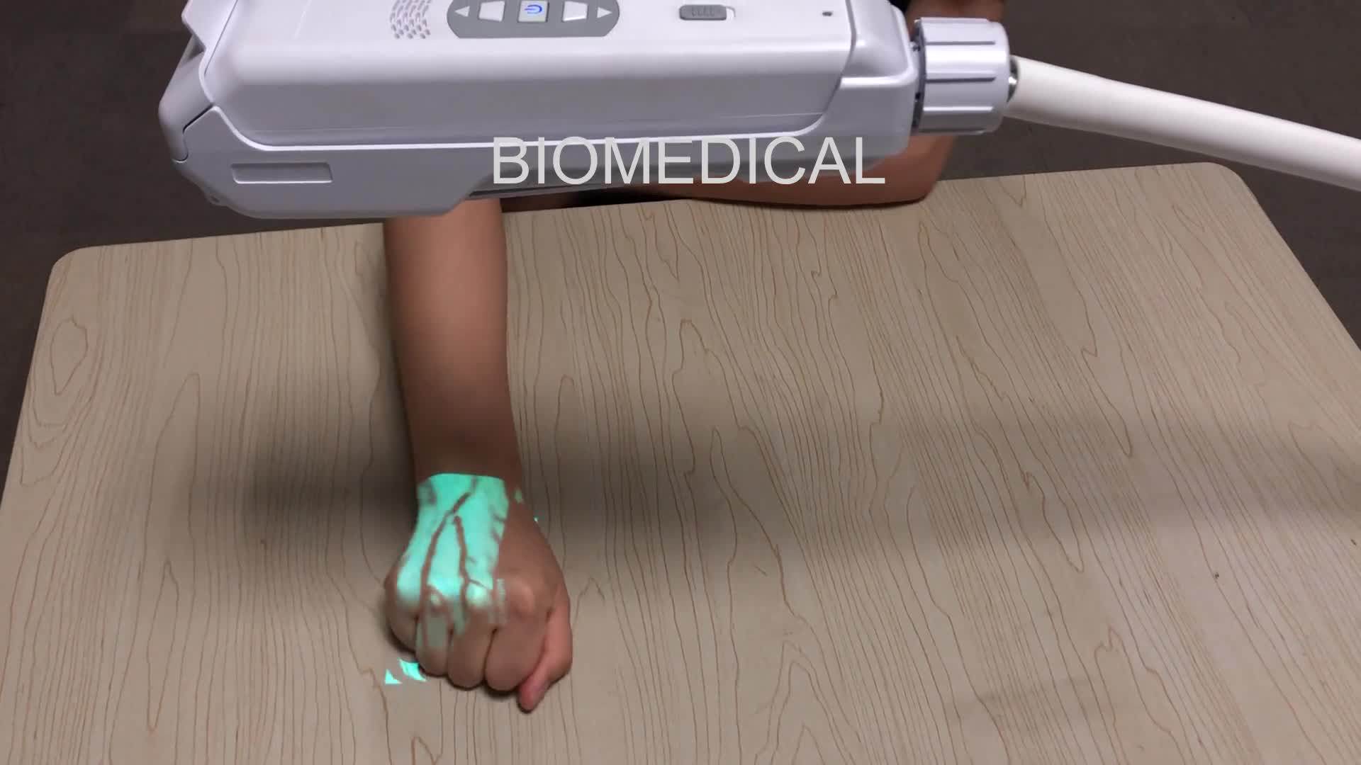 Portable Infrared Vein Viewer / Vein Locator / Vein Finder With Trolley ...