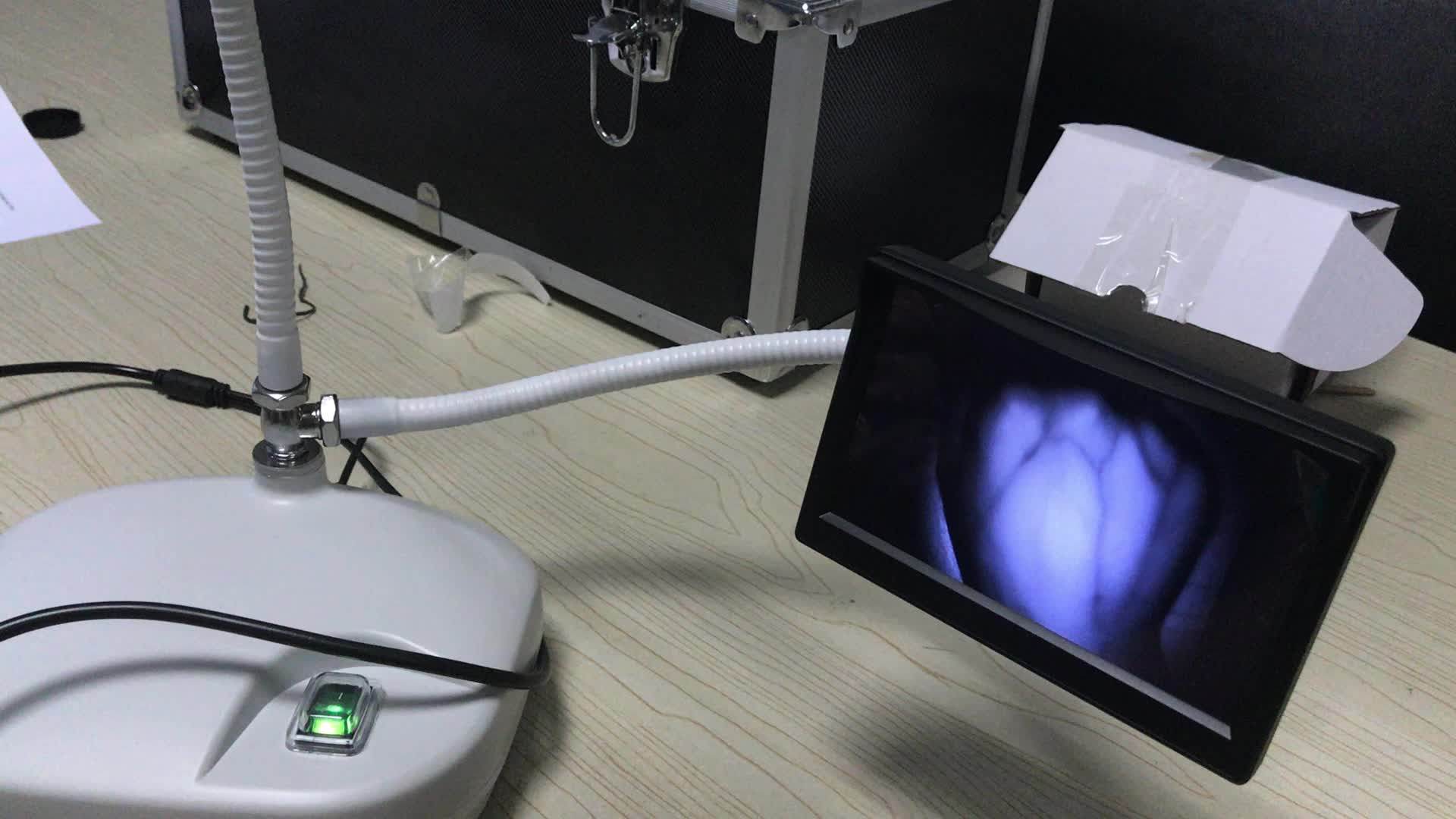 5 Inch Screen Portable Vein Imaging Device Infrared Vein Finder For ...