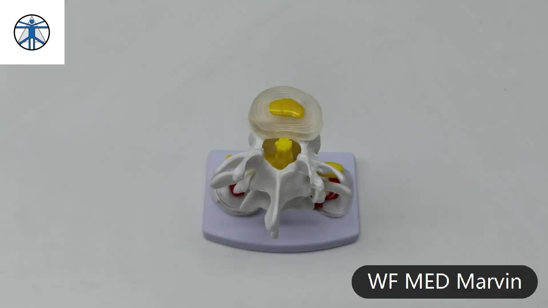 Medical Spine Endoscope Endoscopic Spine Surgery Teaching Model ...