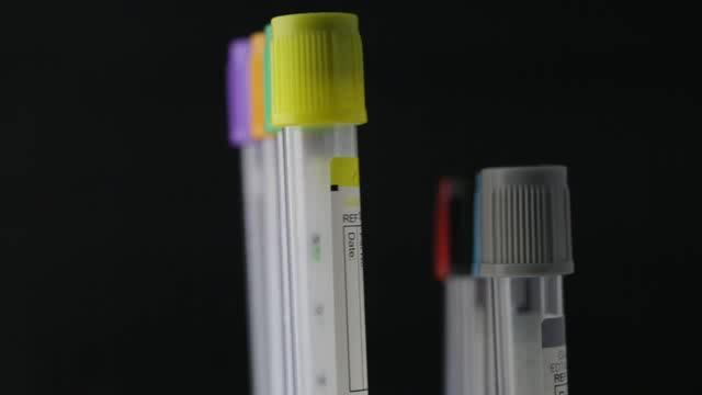 Sodium Flouride Tube 1-8ml Draw Volume Grey Cap Vacuum Blood Collection ...