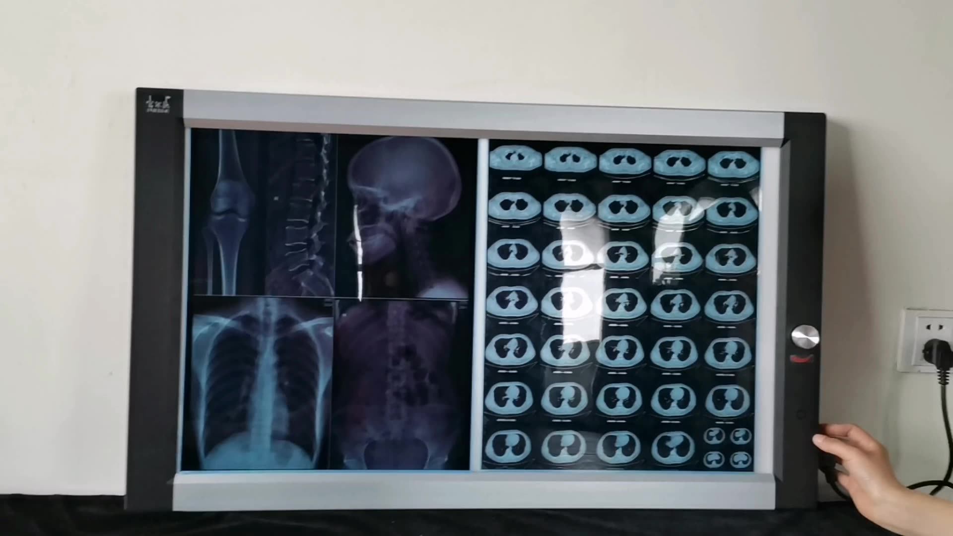 Negatoscope Xray Film Medical Viewer For X-ray Blue Film - Buy ...