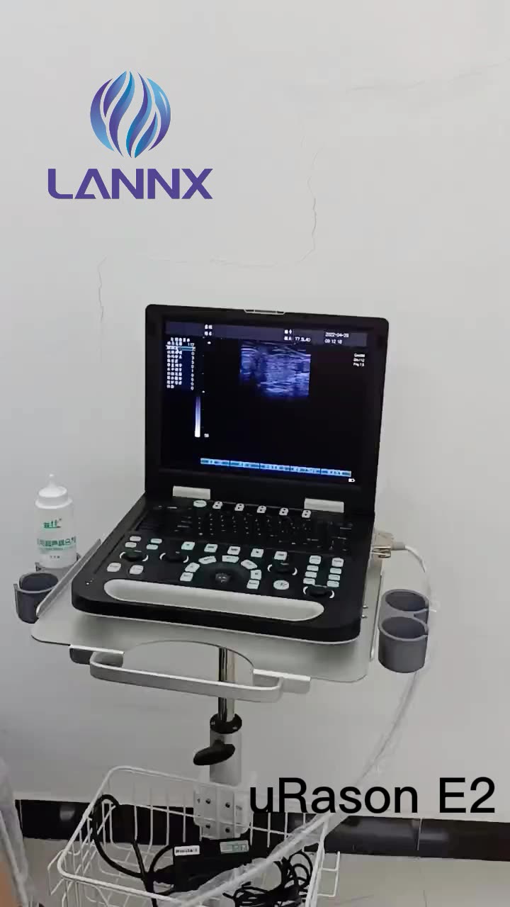 Lannx Urason E2 Medical Imaging Equipment Human Ultrasound Machine 15 Inch Led B/w Notebook ...