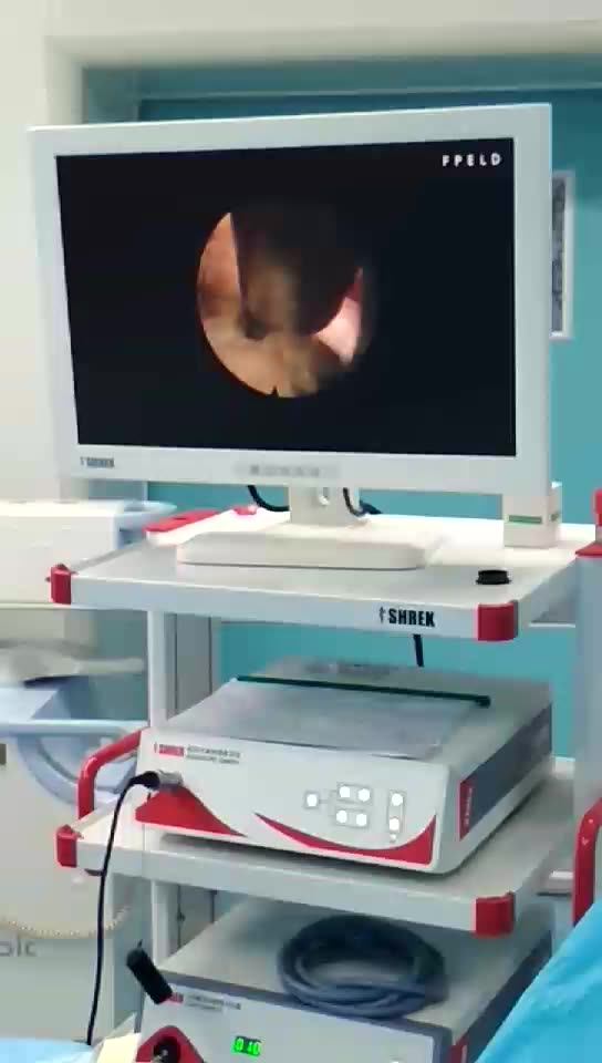 Shrek Hd Cistoscopia Arthroscopic Gynecological Complete Set Endoscopy ...