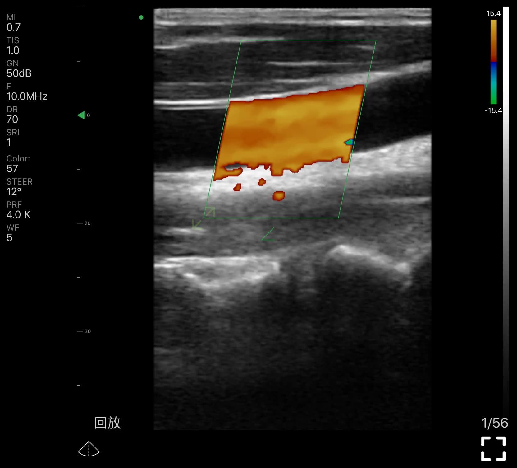 Linear/convex/phased Array 3 In 1 Handheld Usb Ultrasound Double Probes ...