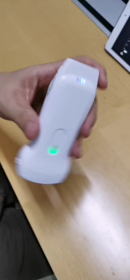 Highest Cost-effective Double Probes Wireless Color Doppler Ultrasound ...