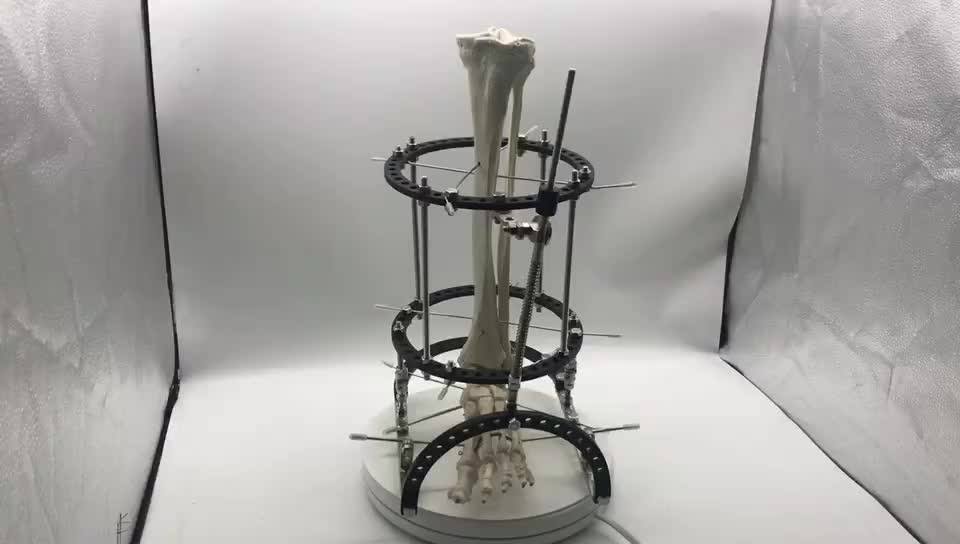 External Fixator Orthopedic Instruments Surgical Fixation Instrument ...