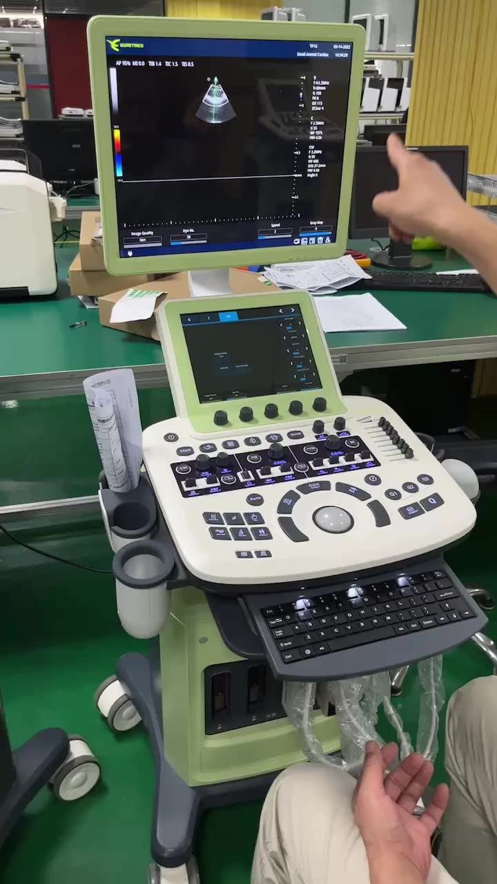 China Manufacturer Gynecology Obstetric Trolley Ultrasound Machine 19 ...