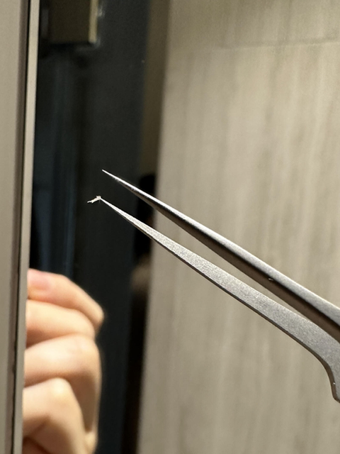 Spot No. 5 super-tip cell clip blackhead removal artifact closed mouth ...